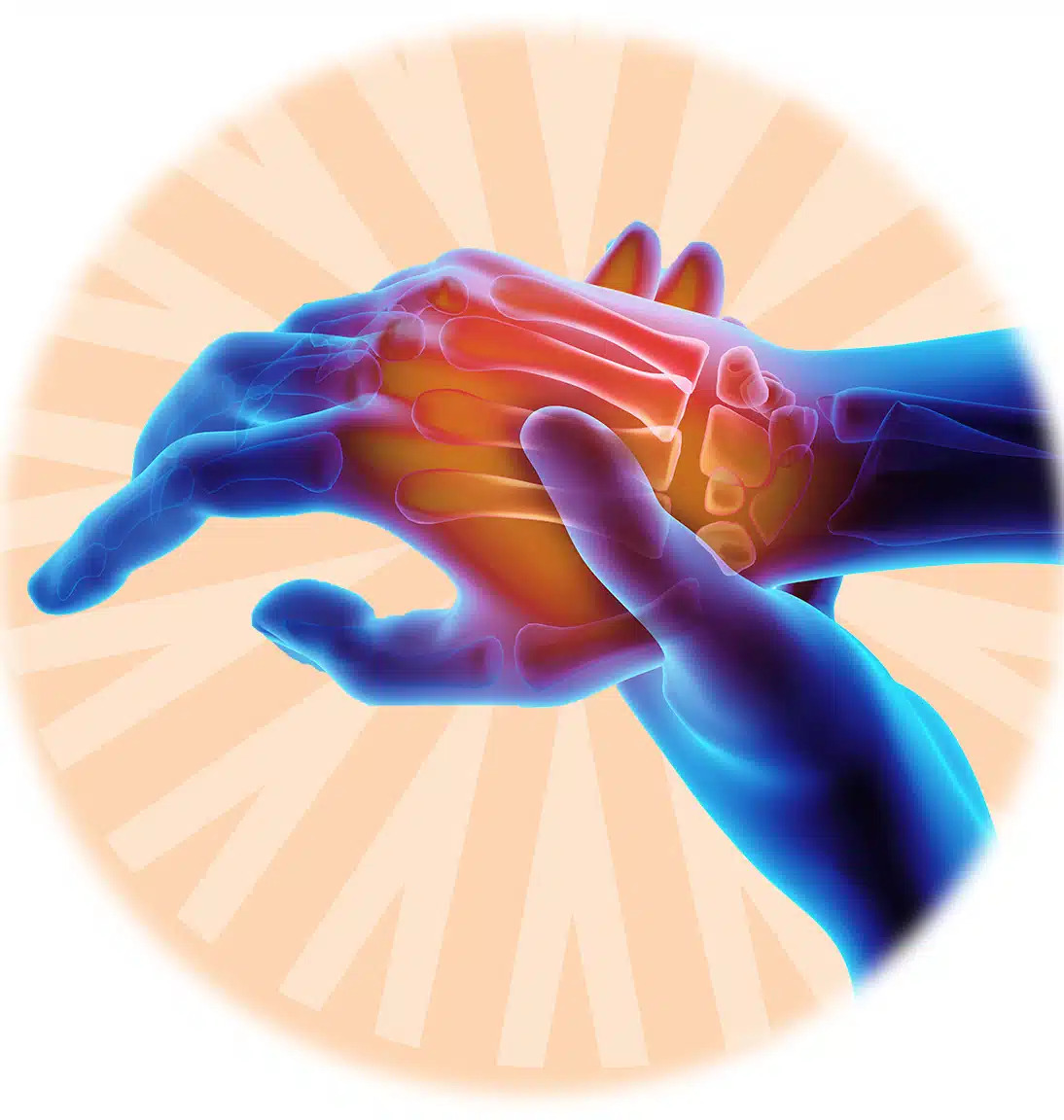 Peripheral Neuropathy